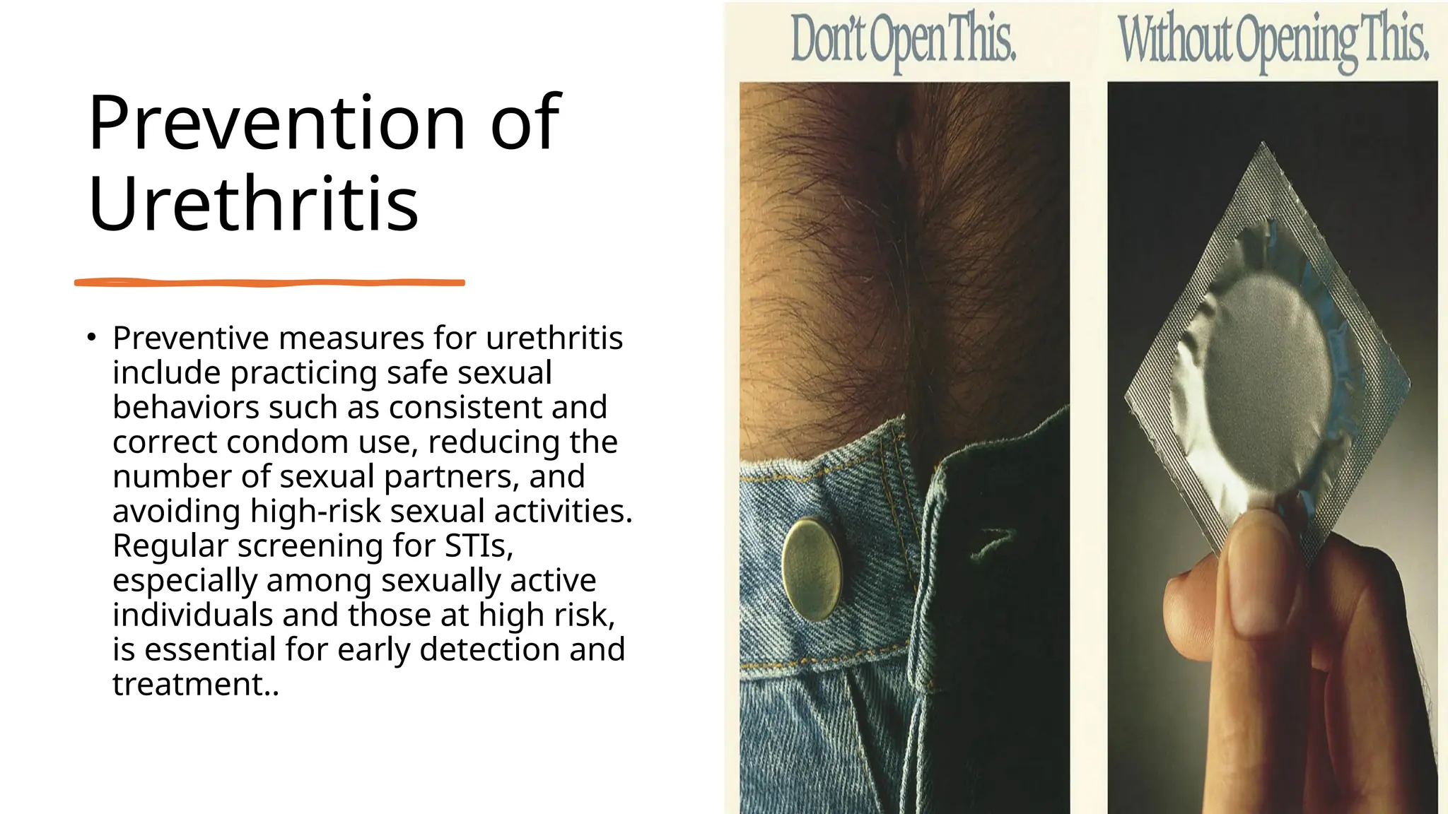 Understanding Urethritis Urology Medicine | PPT