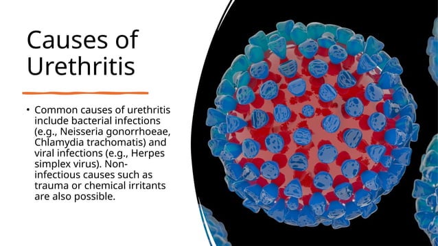 Understanding Urethritis Urology Medicine | PPT