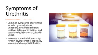Understanding Urethritis Urology Medicine | PPT