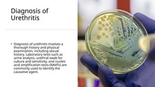 Understanding Urethritis Urology Medicine | PPT