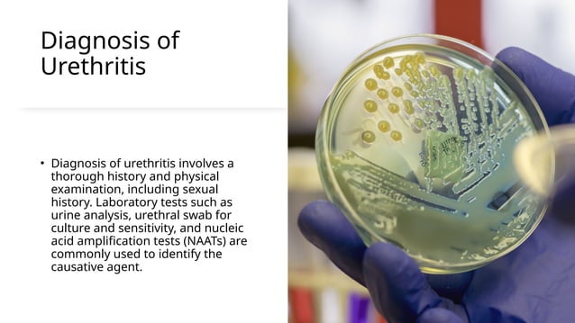 Understanding Urethritis Urology Medicine | PPT