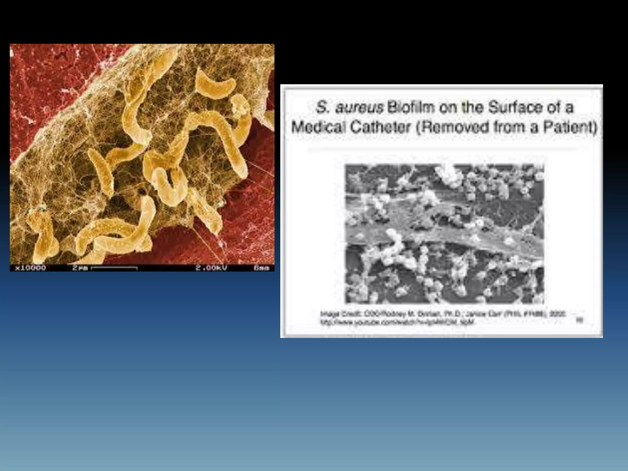 Urology Presentation | PPTX