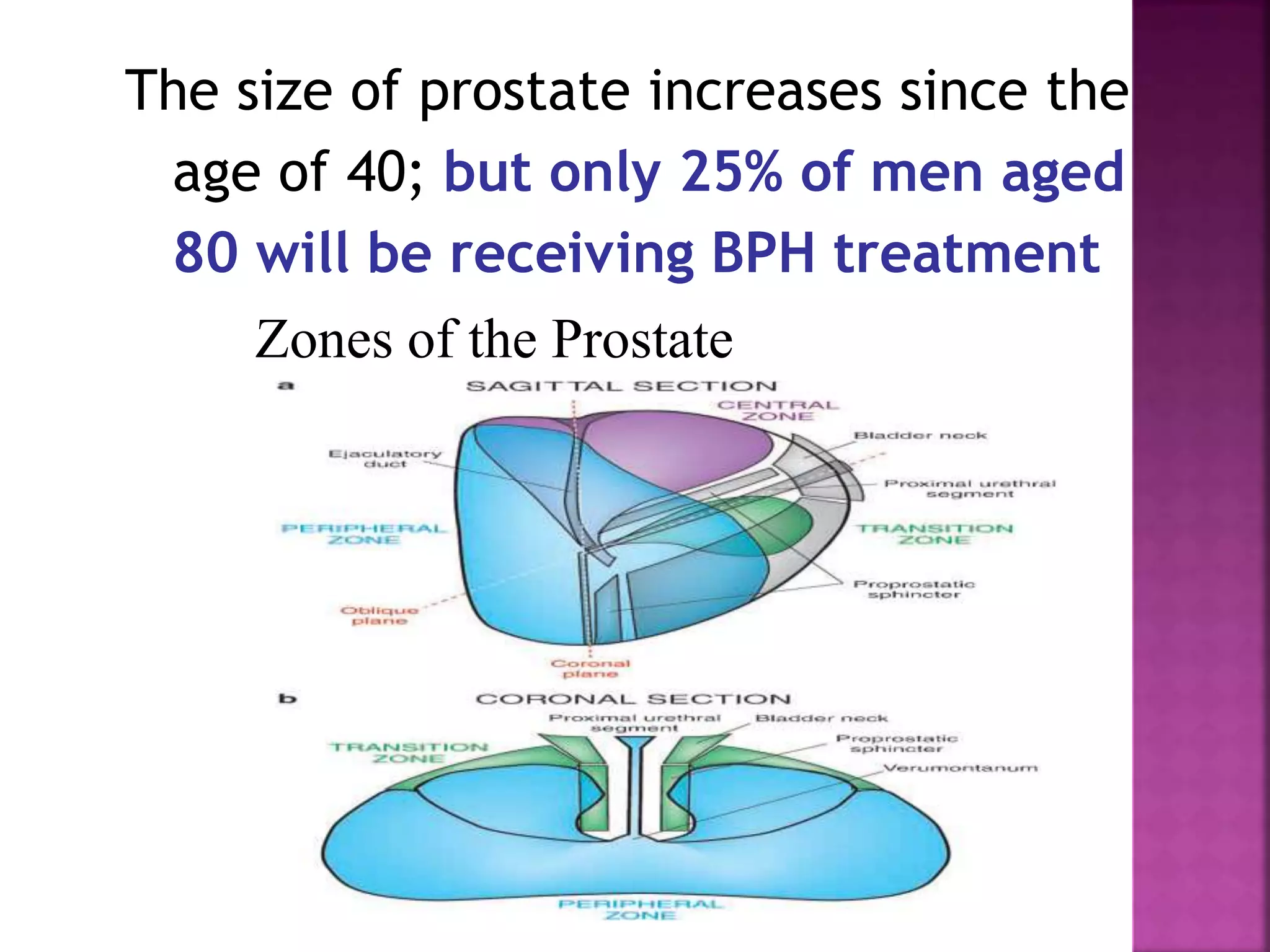 urology presentaton 1 bph.pptx
