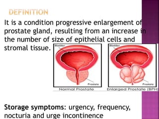 urology presentaton 1 bph.pptx