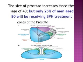 urology presentaton 1 bph.pptx