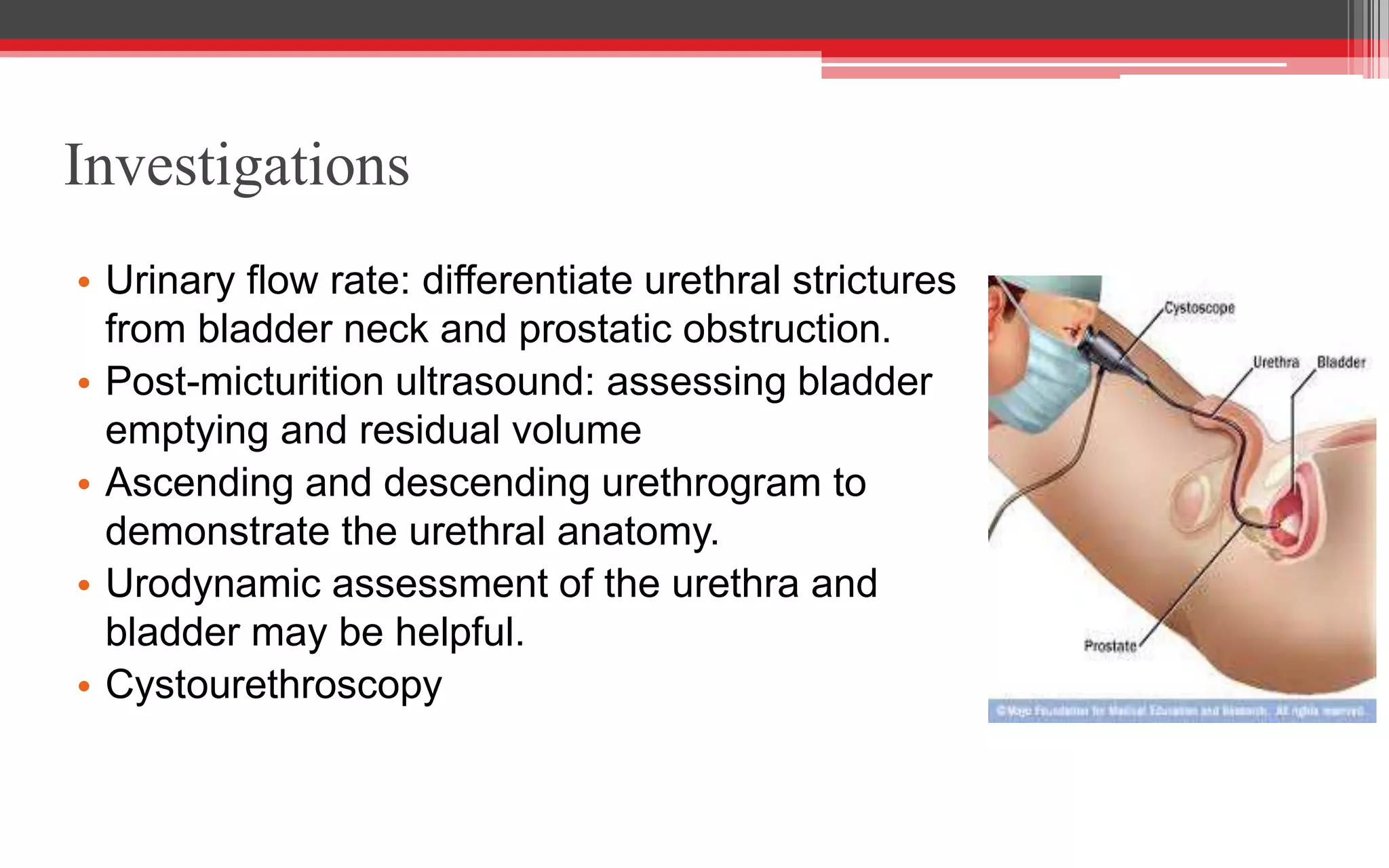 Urology surgery. Bladder, Urethra and Prostsate | PPTX