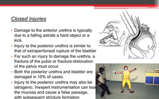 Urology surgery. Bladder, Urethra and Prostsate | PPTX