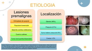 Uro oncología, cáncer renal, cáncer de vejiga, Cáncer de próstata ...