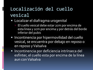 Radiología de la uropatía obstructiva, incontinencia urinaria femenina ...