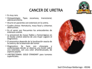 UROPATÍAS ALTAS - RIÑON Y URETERES.pptx