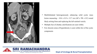 Urology case presentation of hematuria case | PPTX