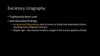Case Presentation: Urothelial Cancer of the Renal Pelvis | PPTX