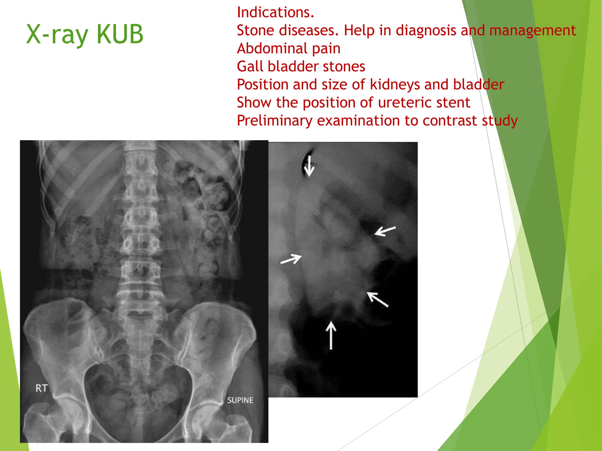 URORADIOLOGY , Investigations in Urology | PPTX