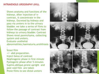 URORADIOLOGY , Investigations in Urology | PPTX