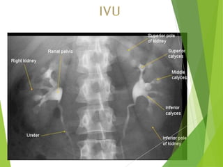 URORADIOLOGY , Investigations in Urology | PPTX