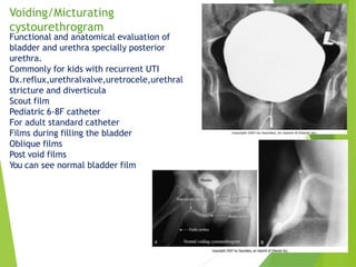 URORADIOLOGY , Investigations in Urology | PPTX
