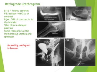 URORADIOLOGY , Investigations in Urology | PPTX