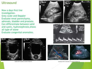 URORADIOLOGY , Investigations in Urology | PPTX