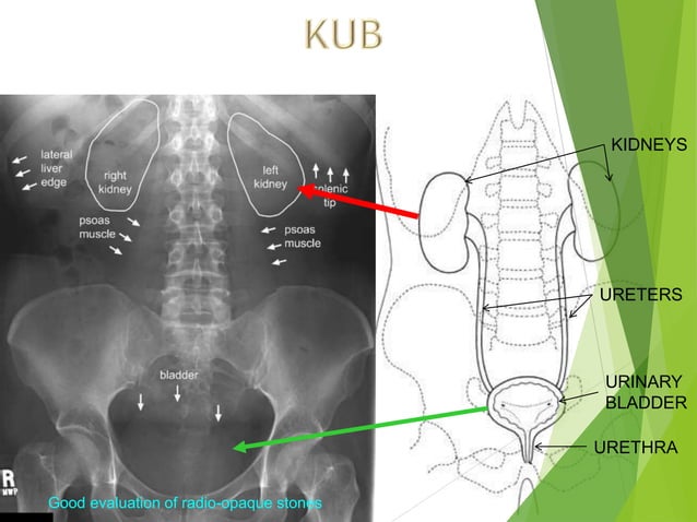 URORADIOLOGY , Investigations in Urology | PPTX | Medical Tests ...