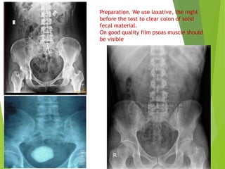 URORADIOLOGY , Investigations in Urology | PPTX | Medical Tests ...