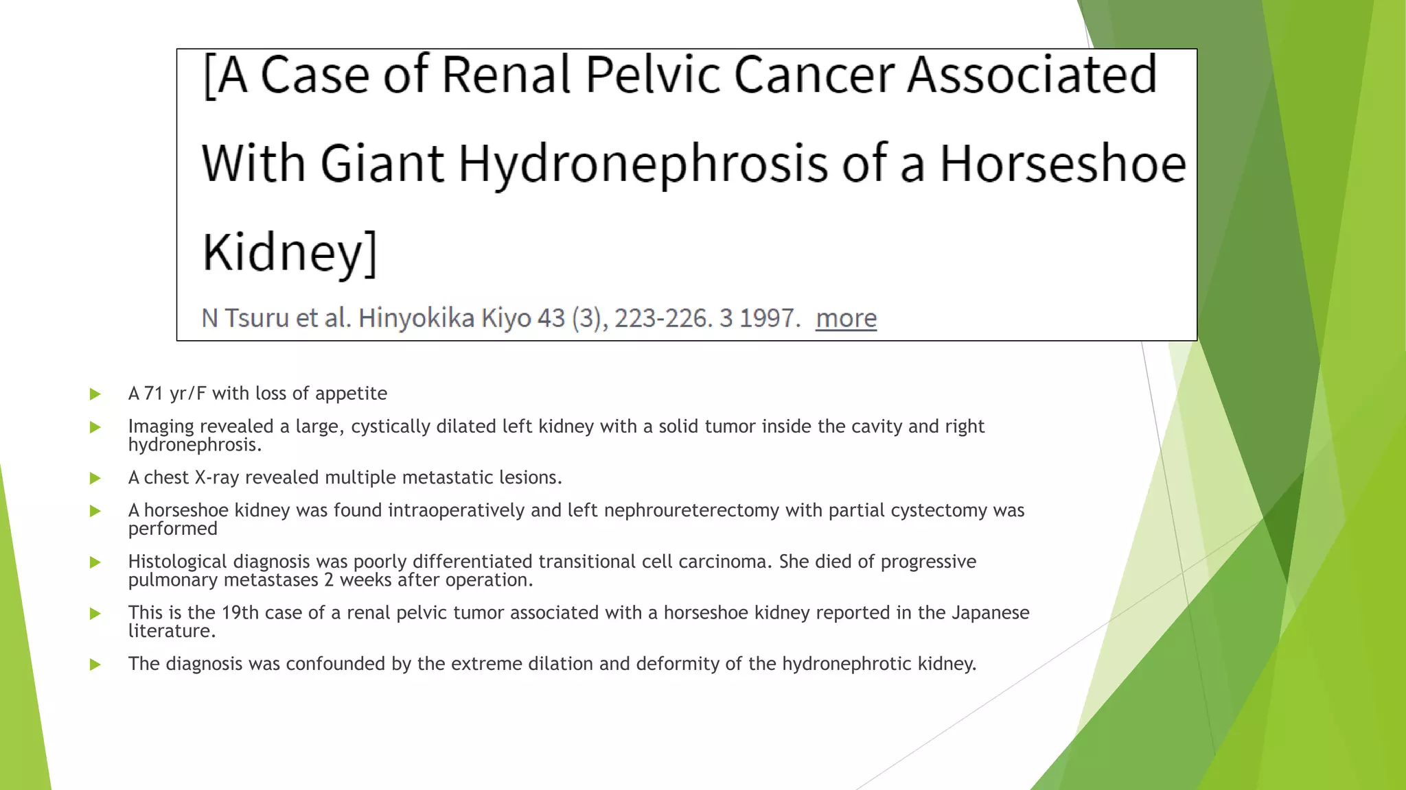 approach to Urothelial carcinoma of upper tract in horse shoe kidney | PPTX