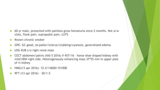 approach to Urothelial carcinoma of upper tract in horse shoe kidney | PPT