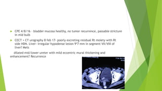approach to Urothelial carcinoma of upper tract in horse shoe kidney | PPT