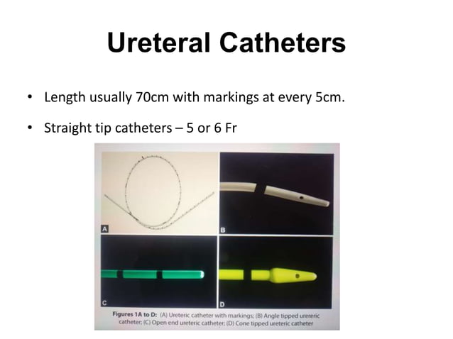 Ureteroscopic lithotripsy (URSL) | PPTX