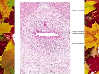 Histología De La Uretra Prostática