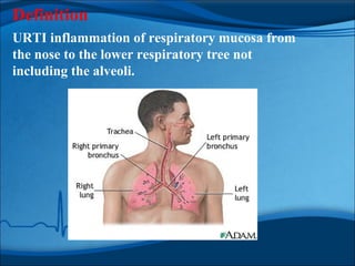 Urti | PPT