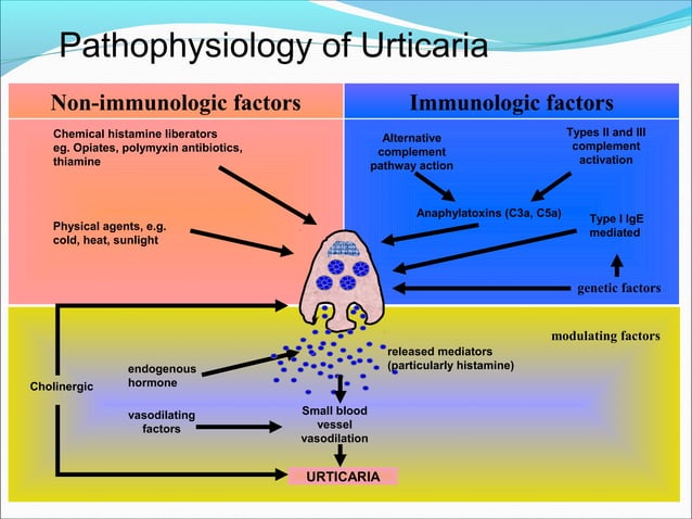 clinical approach to Urticaria AND ANGIODEMA | PPT | Skin and ...