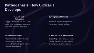 URTICARIA (Hives) and it's types.itiology, diagnosis | PPTX