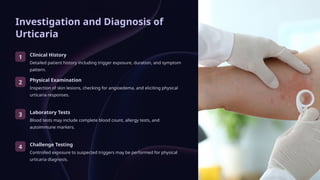 URTICARIA (Hives) and it's types.itiology, diagnosis | PPT