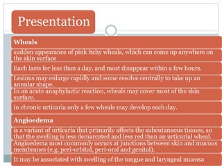 Urticaria | PPTX