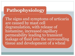 Urticaria | PPTX