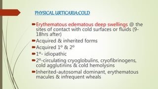 Urticaria | PPTX
