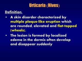 Urticaria | PPT