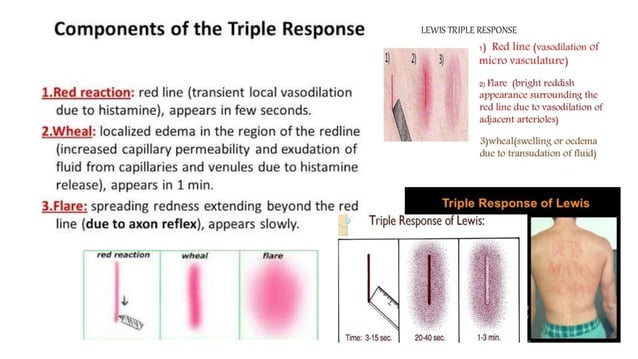 Urticaria clinical features dermatology | PPTX