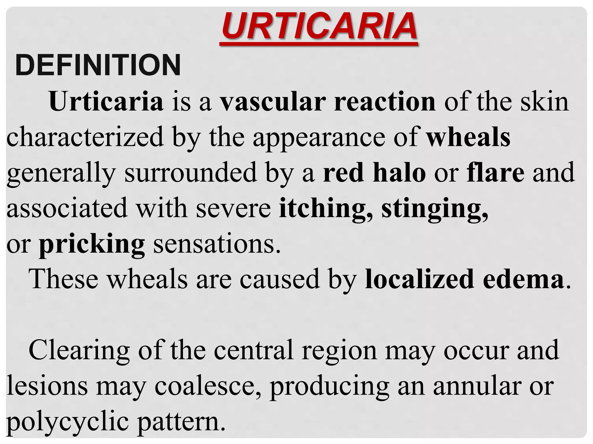 urticaria .pptx