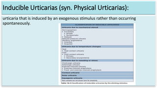 Urticaria ,types and management bolognia .pptx