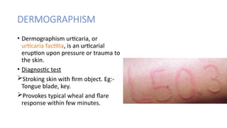 Identify and distinguish urticaria with other skin lesions | PPTX