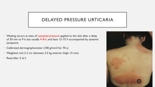 Urticaria and angioedema.pptx for dermatologist | PPTX