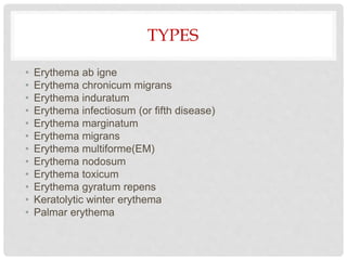 Urticaria and erythema | PPT