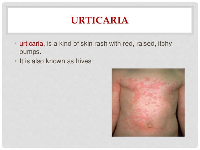 Urticaria and erythema