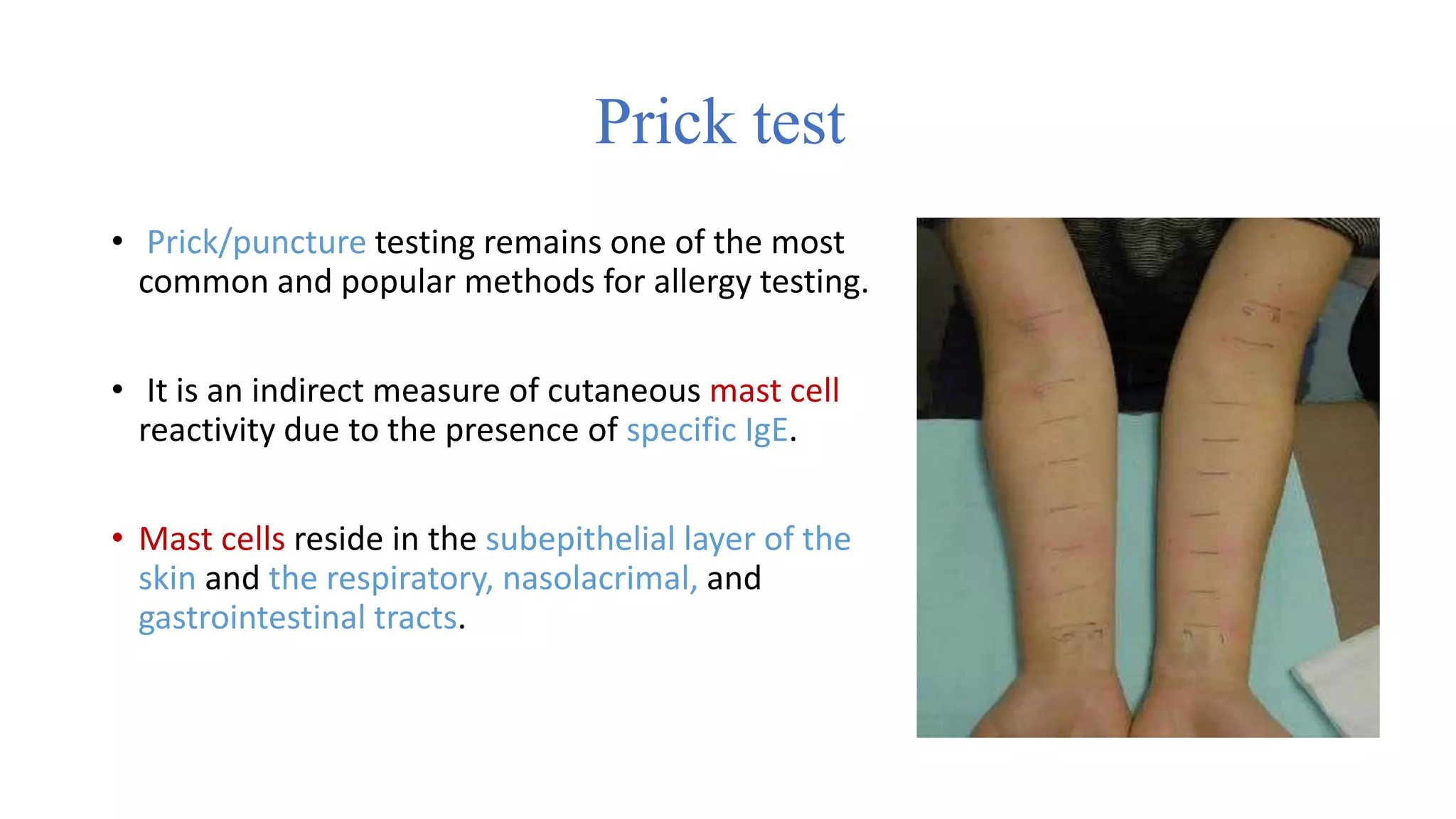 urticaria and skin allergy tests.pptx