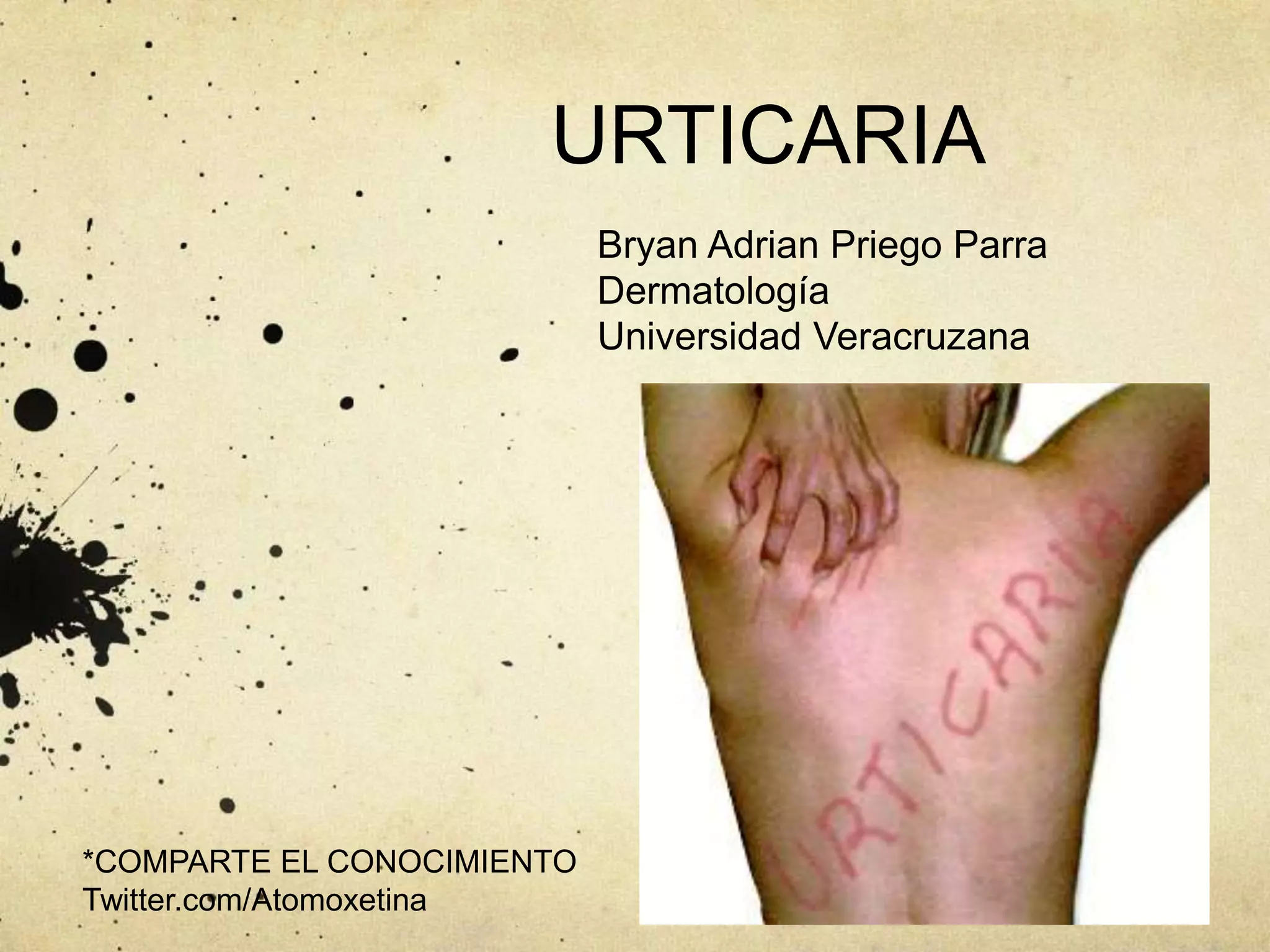 Urticaria Aguda y Cronica, Física, Dermografismo, Térmica, Colinérgica ...