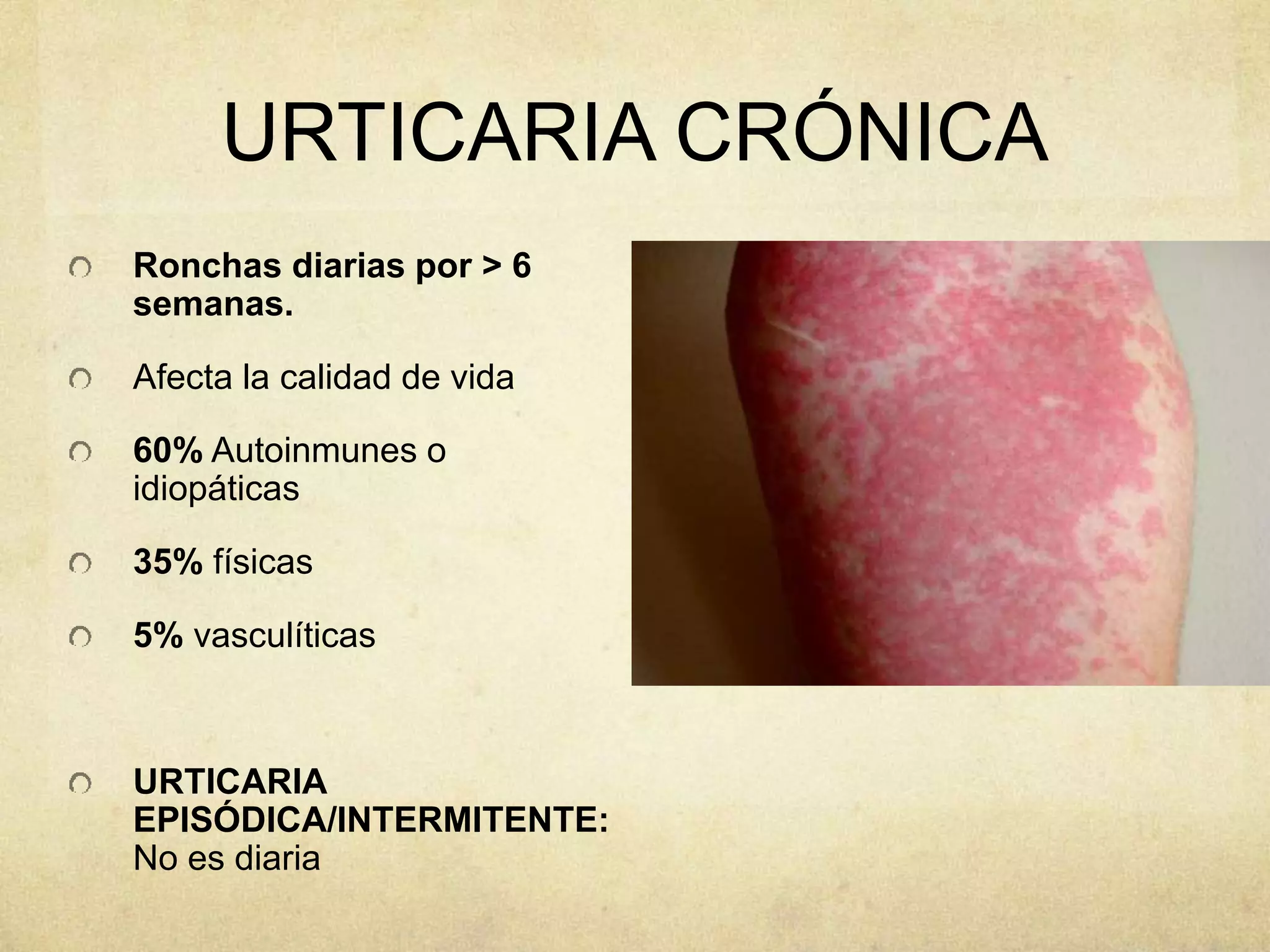 Urticaria Aguda y Cronica, Física, Dermografismo, Térmica, Colinérgica ...