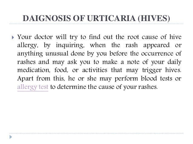 Urticarias Physical Causes Symptoms Treatment Urticaria (Hives)