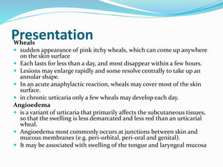 Urticaria (hives, ‘nettle rash’) | PPTX