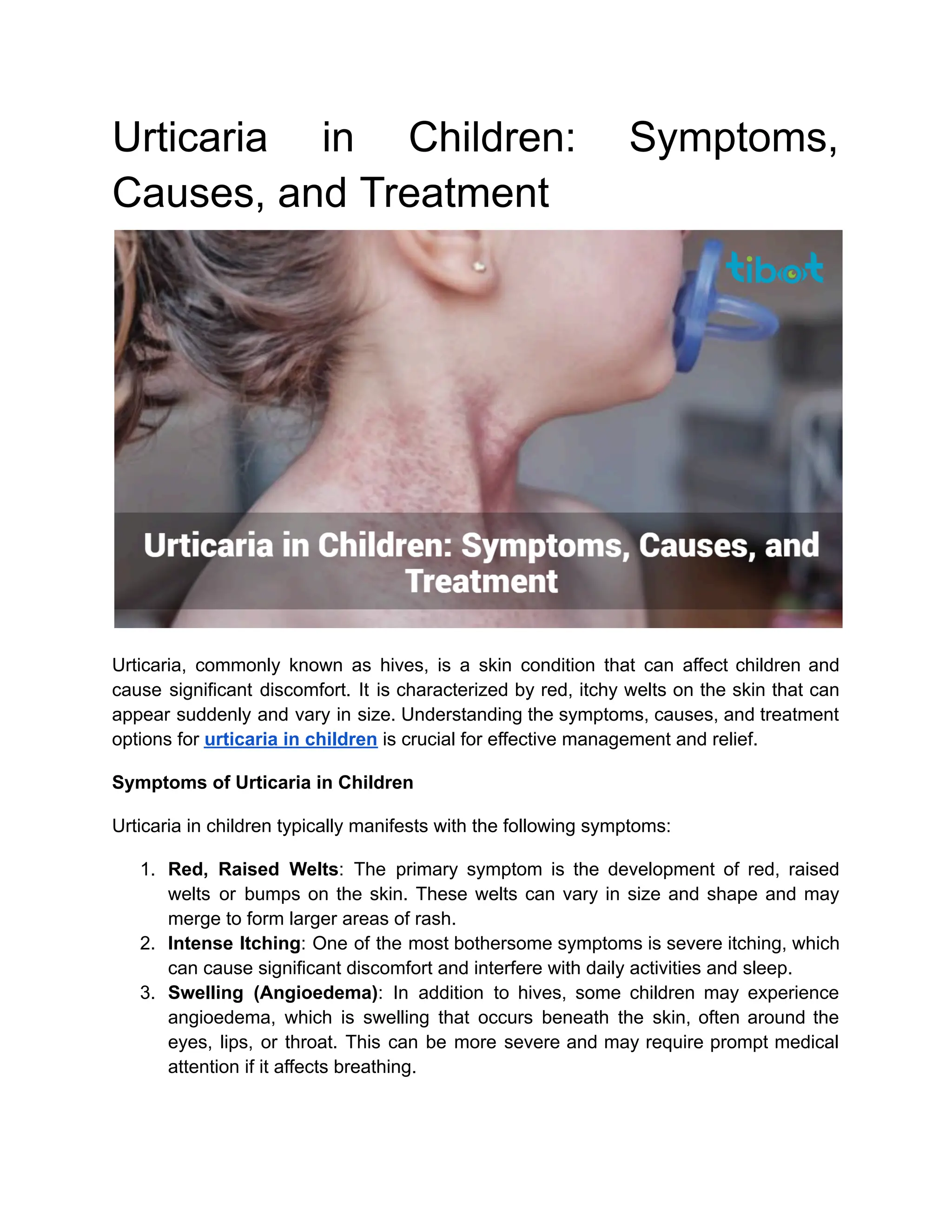 Urticaria in Children: Symptoms, Causes, and Treatment | PDF
